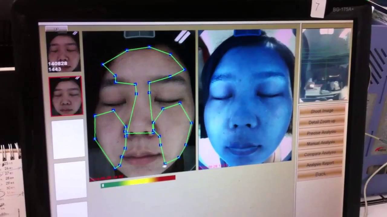 Skin Analyzer Device | MAIKONG Skin Observed System|skin Analysis|skin ...